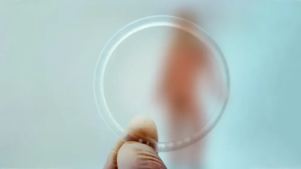 How Much Does a Birth Control Ring Cost Without Insurance? | Mira Health