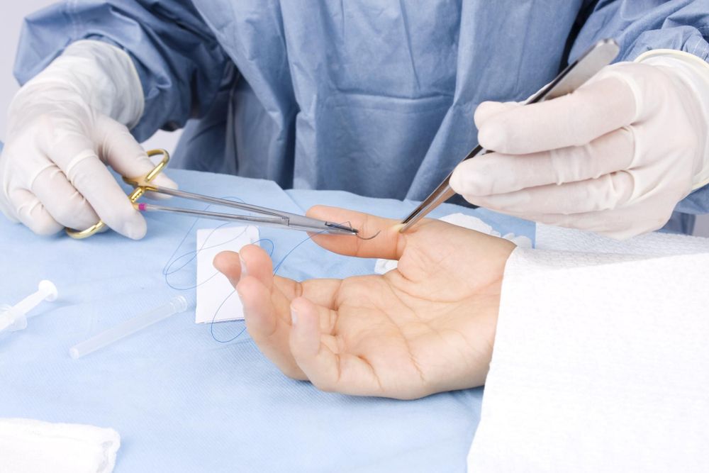 How To Tell If You Need Stitches? | Mira Health